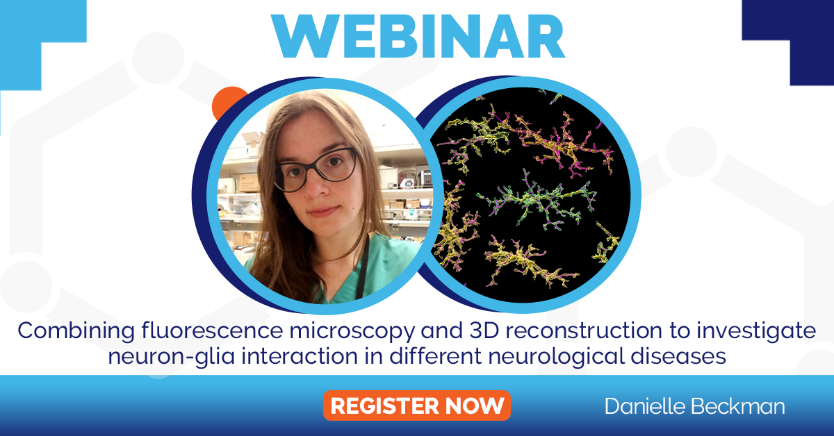 Combining Fluorescence Microscopy And 3d Reconstruction To Investigate Neuron Glia Interaction