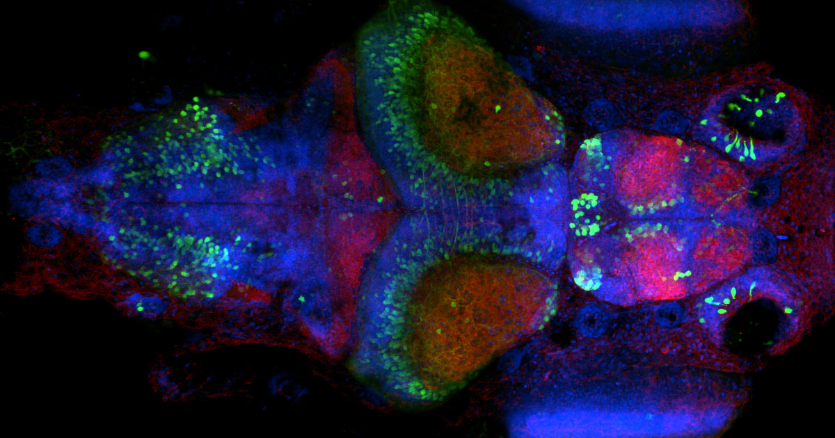 Confocal Microscope Price – The Impacting Factors- Oxford Instruments