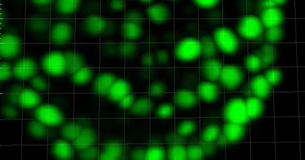 Learn how to detect objects in Imaris using the Surfaces model- Oxford Instruments