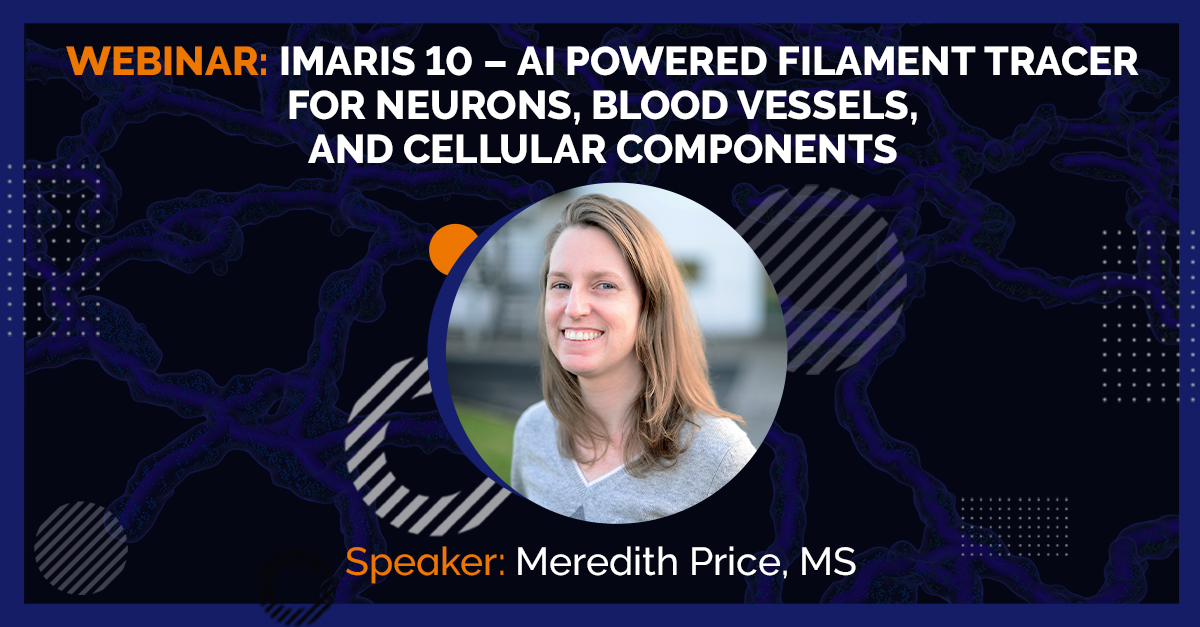 Imaris 10 – AI Powered Filament Tracer for Neurons, Blood Vessels, and ...
