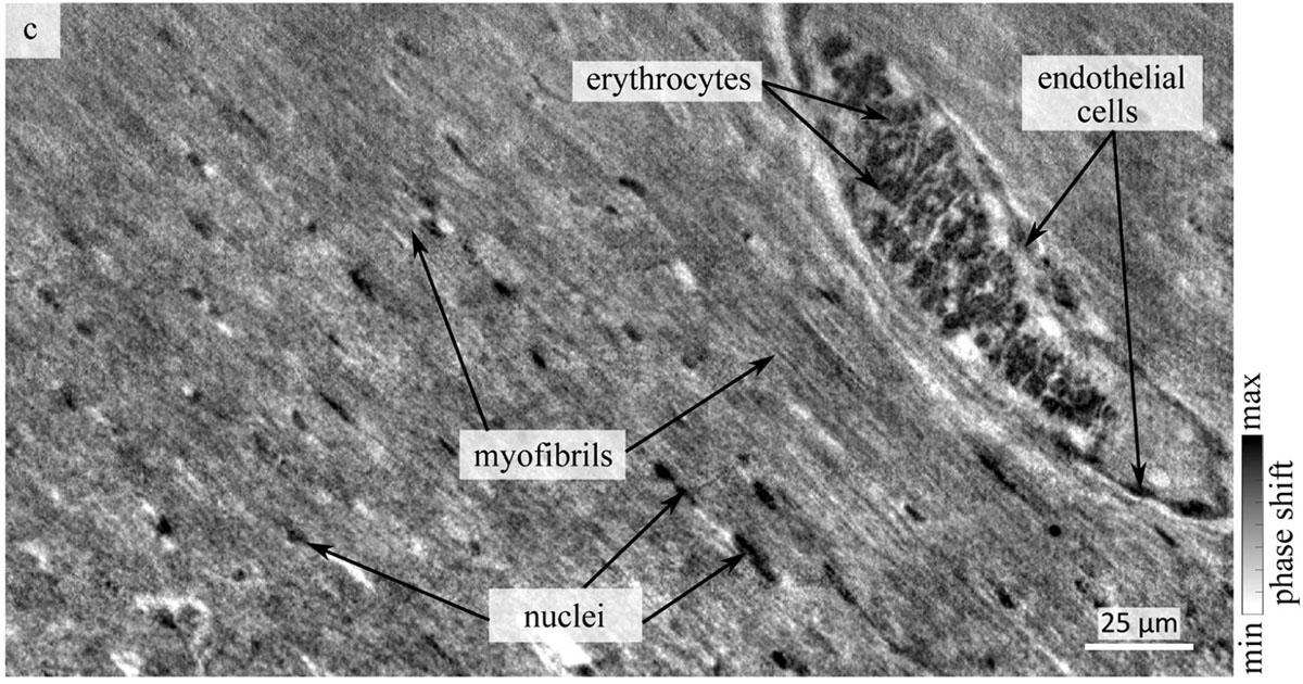 X Ray Phase Contrast Tomography Of Biological Samples Oxford Instruments