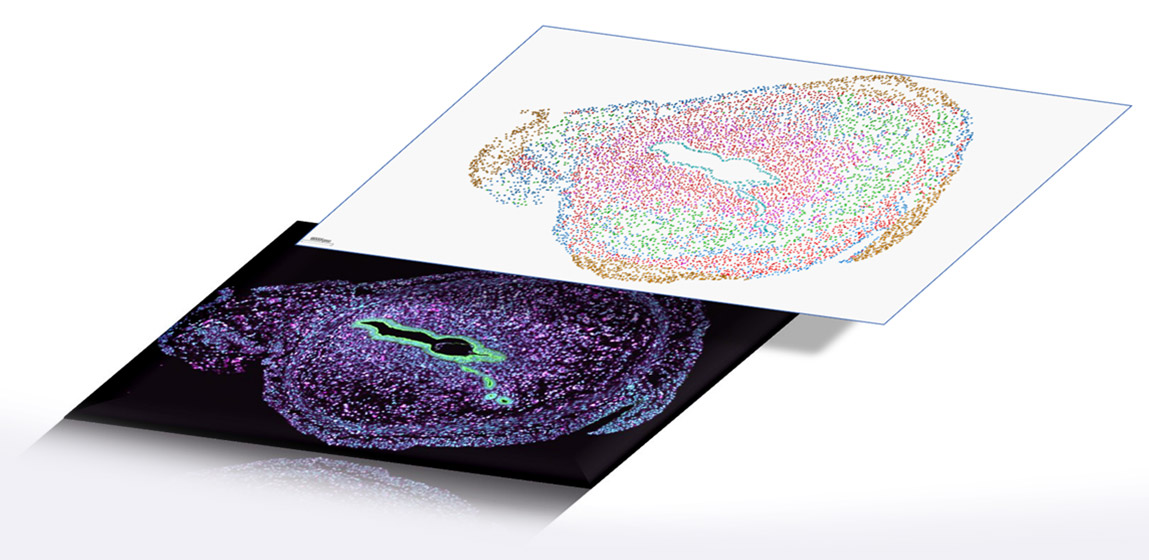 Imaging on a large scale: Expansion Microscopy and Spatially Resolved ...