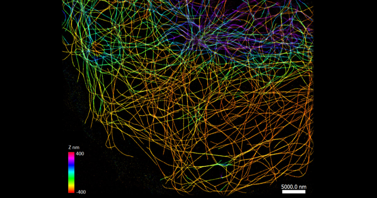 Overview of Single Molecule Localization Microscopy (SMLM)- Oxford ... Overview of Single Molecule Localization Microscopy (SMLM)- Oxford ...