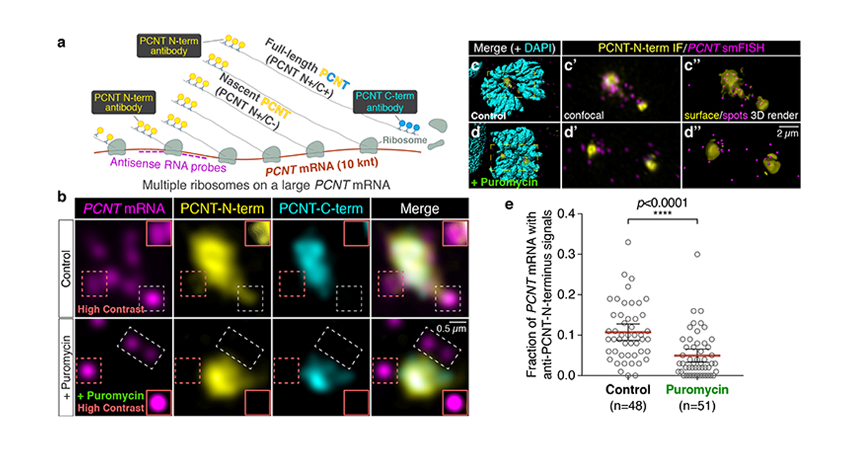 Researchers Use Image Analysis to see Centrosome Maturation