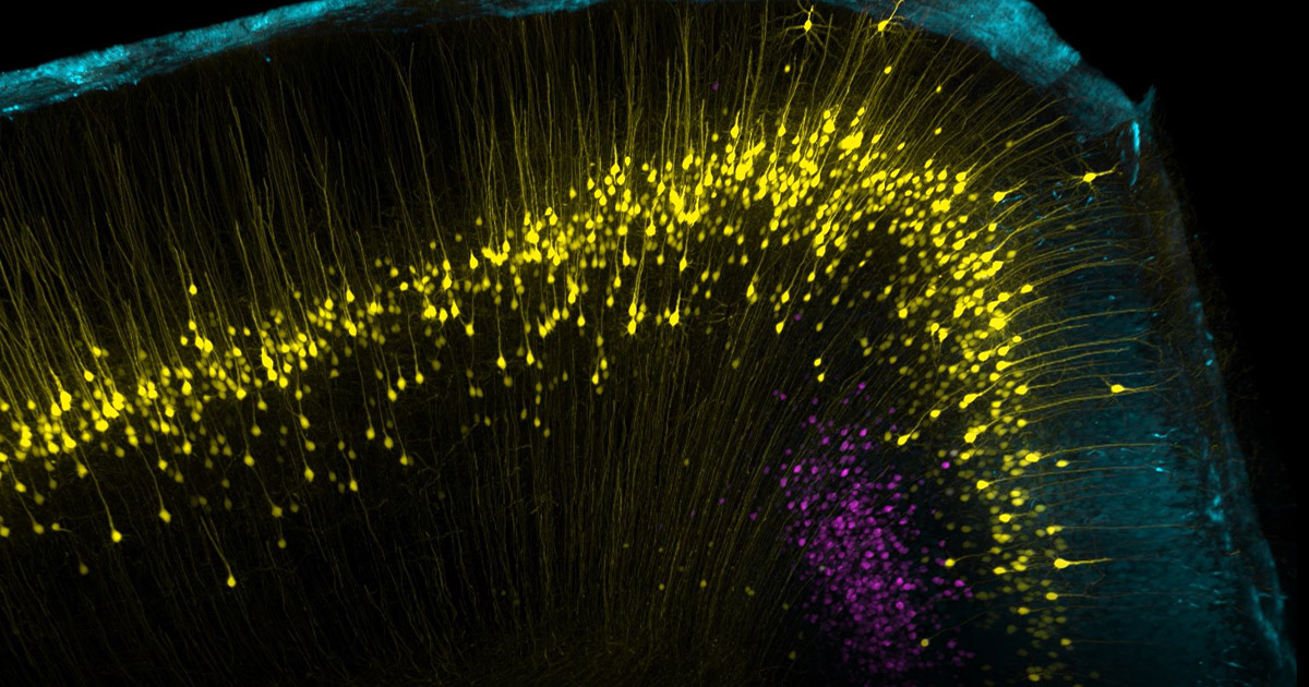 Confocal Imaging of Thick and Cleared Fluorescent Tissue Using Spinning ...