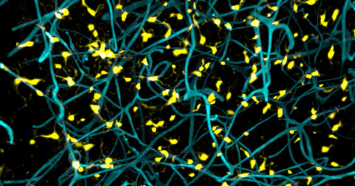 How to use Imaris to check if the Spots Accumulate around the Surface- Oxford Instruments