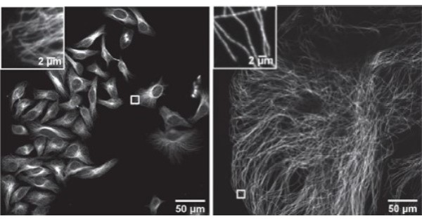 Dragonfly: The Ideal Confocal System for Expansion Microscopy- Oxford ...