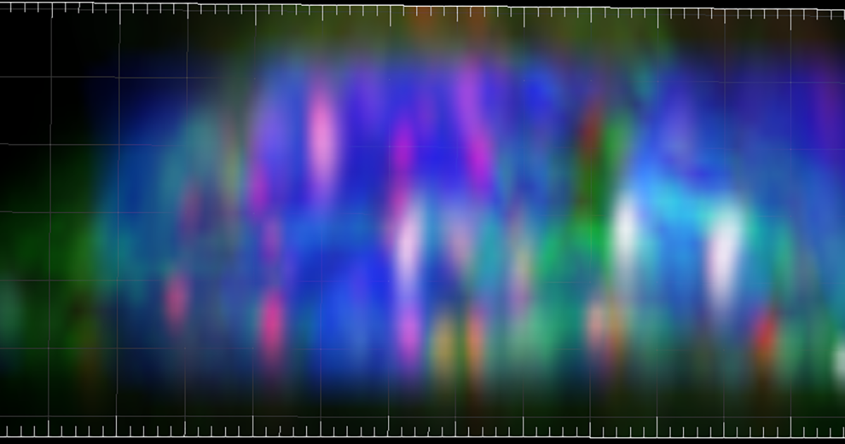 3D to 2D Projection - Imaris Learning Centre- Oxford Instruments