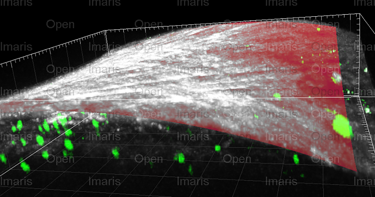 Distance from Modeled Surface to Imaris Surfaces - Imaris Learning ...
