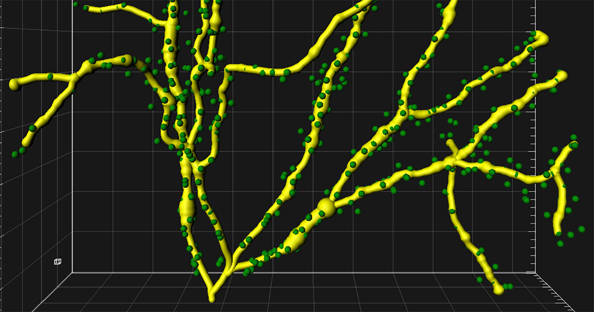Spots Close To Filaments - Imaris Learning Centre- Oxford Instruments
