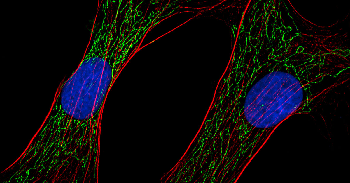 Super-Resolution Microscopy Accessible to All- Oxford Instruments